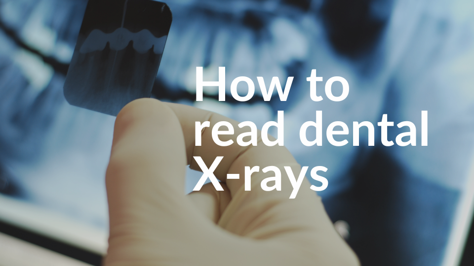 How to Read Dental X-rays | Dental billing training